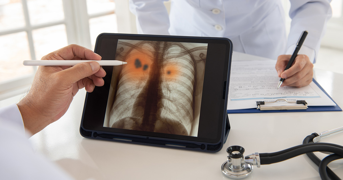 Karmanos Cancer Institute Recognizes Lung Cancer Awareness Month ...